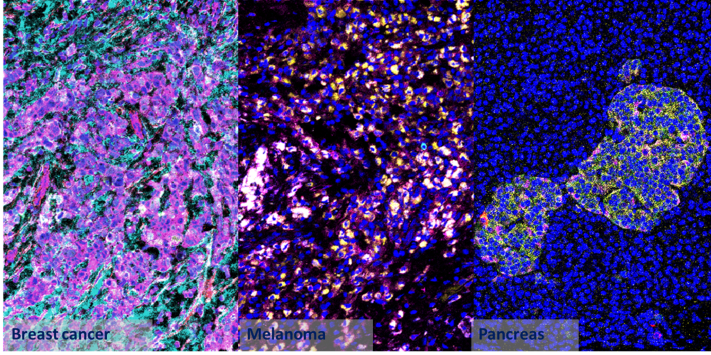 Spatial Bioanalysis & Biology Solutions - Aliri Bioanalysis
