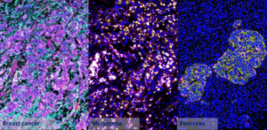 Imaging Mass Cytometry (IMC) - Aliri Bioanalysis