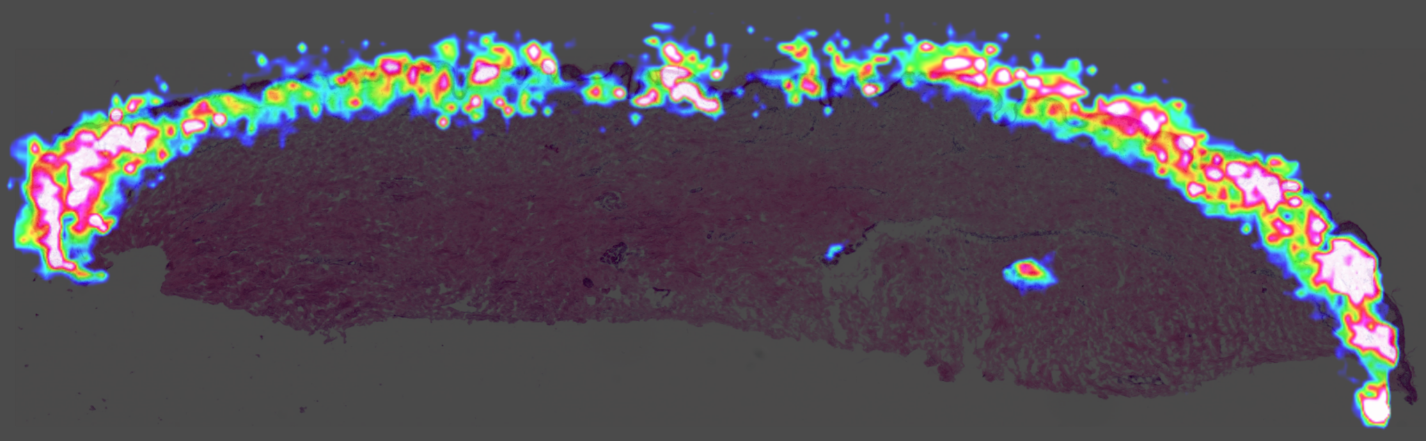 In Vitro Penetration Test (IVPT) - Aliri Bioanalysis
