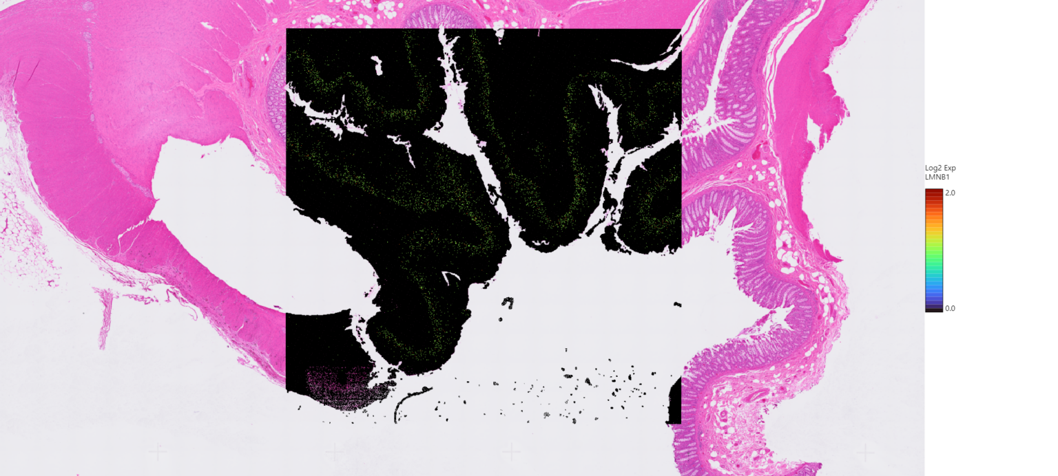 Visium & Visium HD - Aliri Bioanalysis